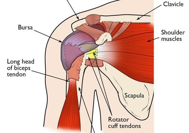 Σύνδρομο Υπακρωμιακής Πρόσκρουσης – Γιώργος Χατζημαρκάκης